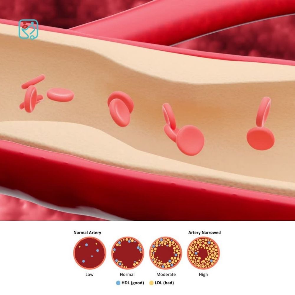 Understand your cholesterol test results